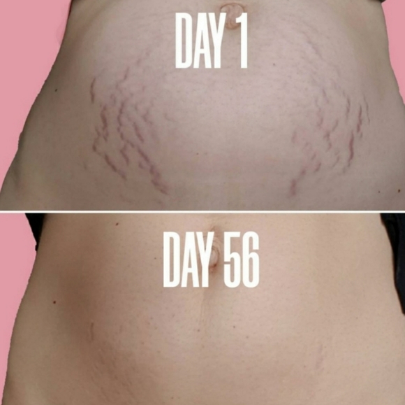 Maelys | Bath & Body | Deluxe Sample Maelys Bflat Belly Firming Cream | Poshmark